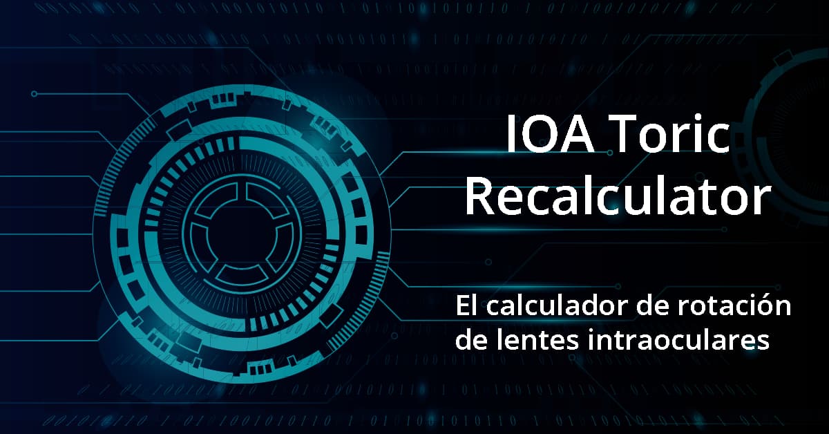 IOA Toric Recalculator - FacoElche.com